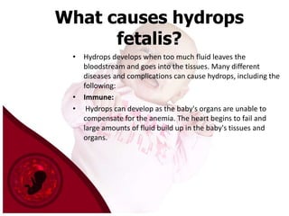 Hydrops | PPTX