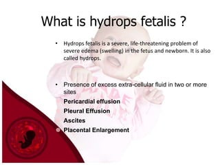 Hydrops Fetalis
