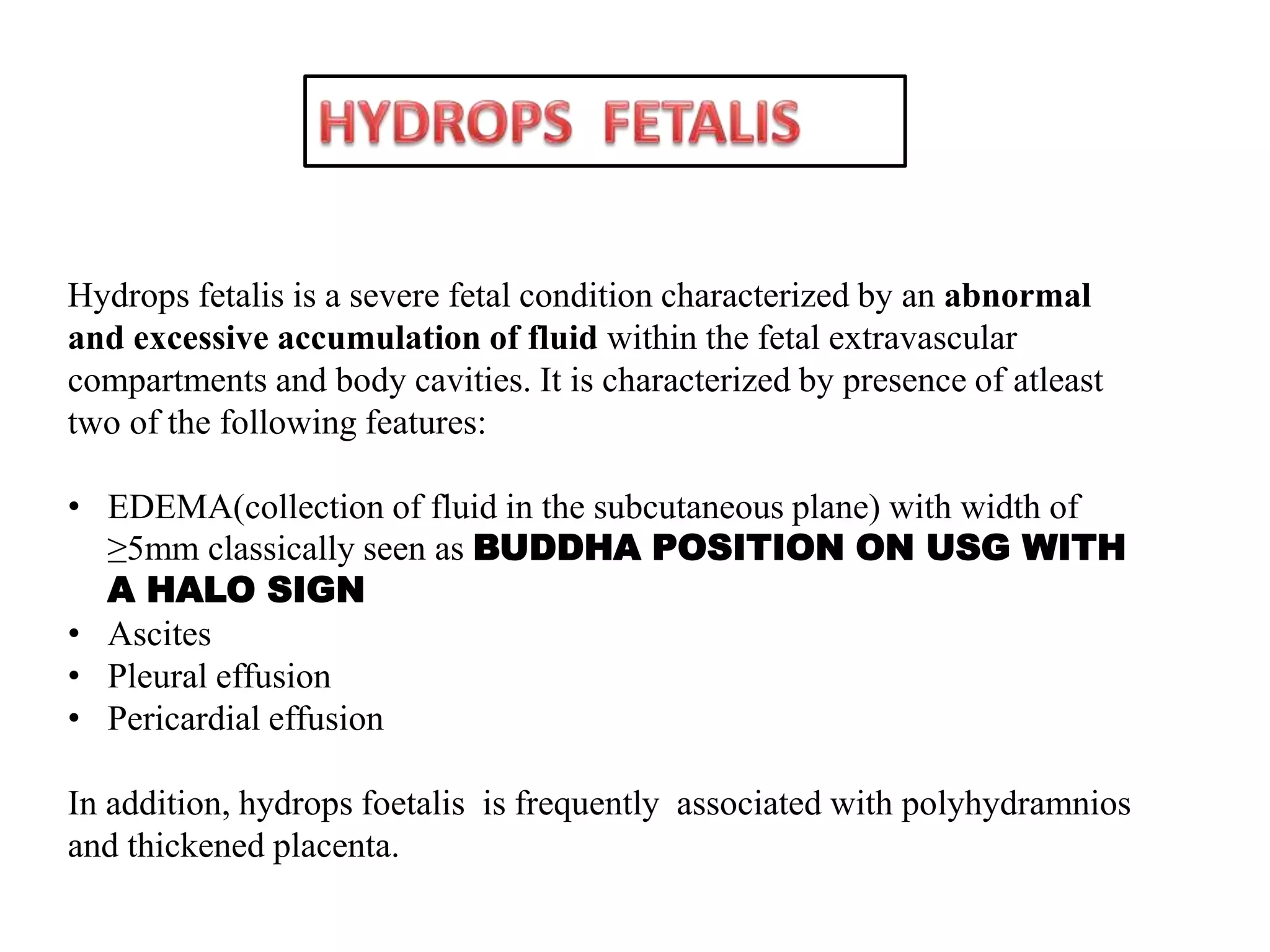 hydrops%20fetalis.pptx