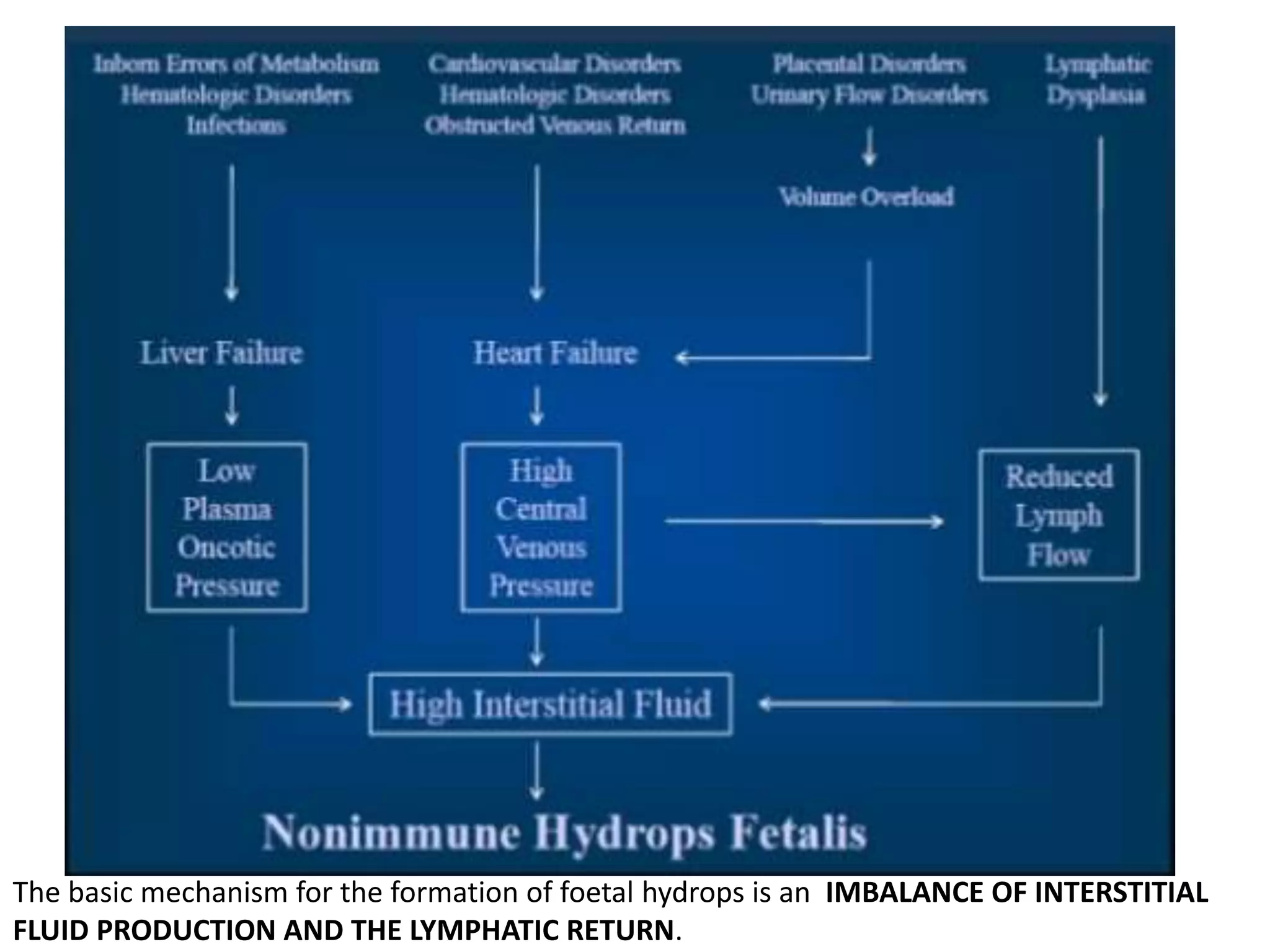 hydrops%20fetalis.pptx