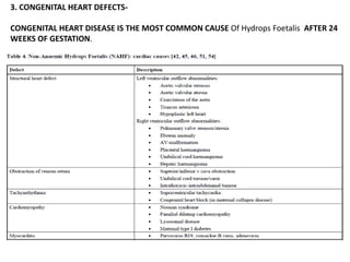 hydrops%20fetalis.pptx