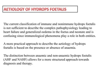 hydrops%20fetalis.pptx