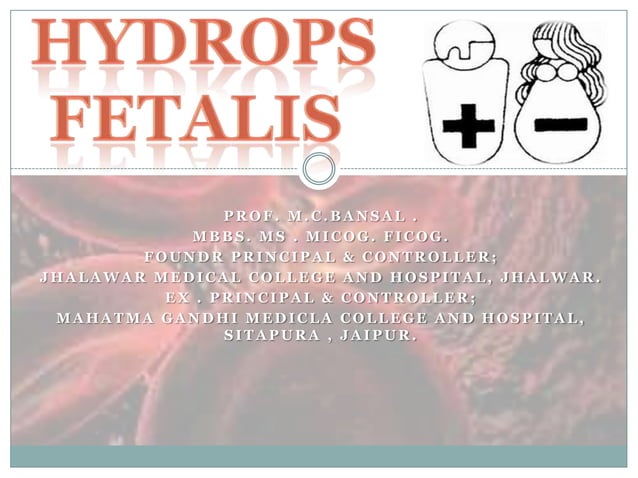 Hydrops fetalis | PPTX | Pregnancy | Reproductive Health