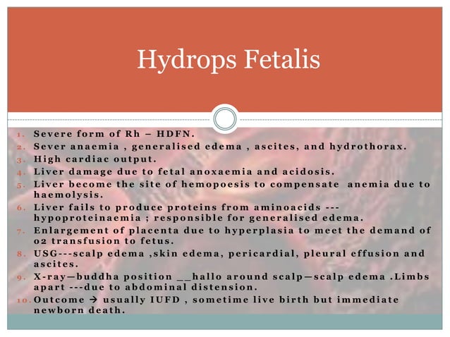 Hydrops fetalis