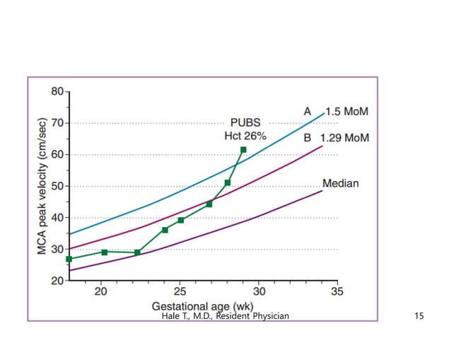 Hydrops fetalis: Immune and nonimmune fetal hydrops | PDF | Pregnancy ...