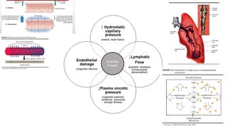 HYDROPS FETALIS- all about it, dfinition and managemnt | PDF