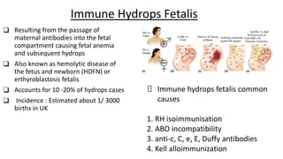 HYDROPS FETALIS- all about it, dfinition and managemnt | PDF