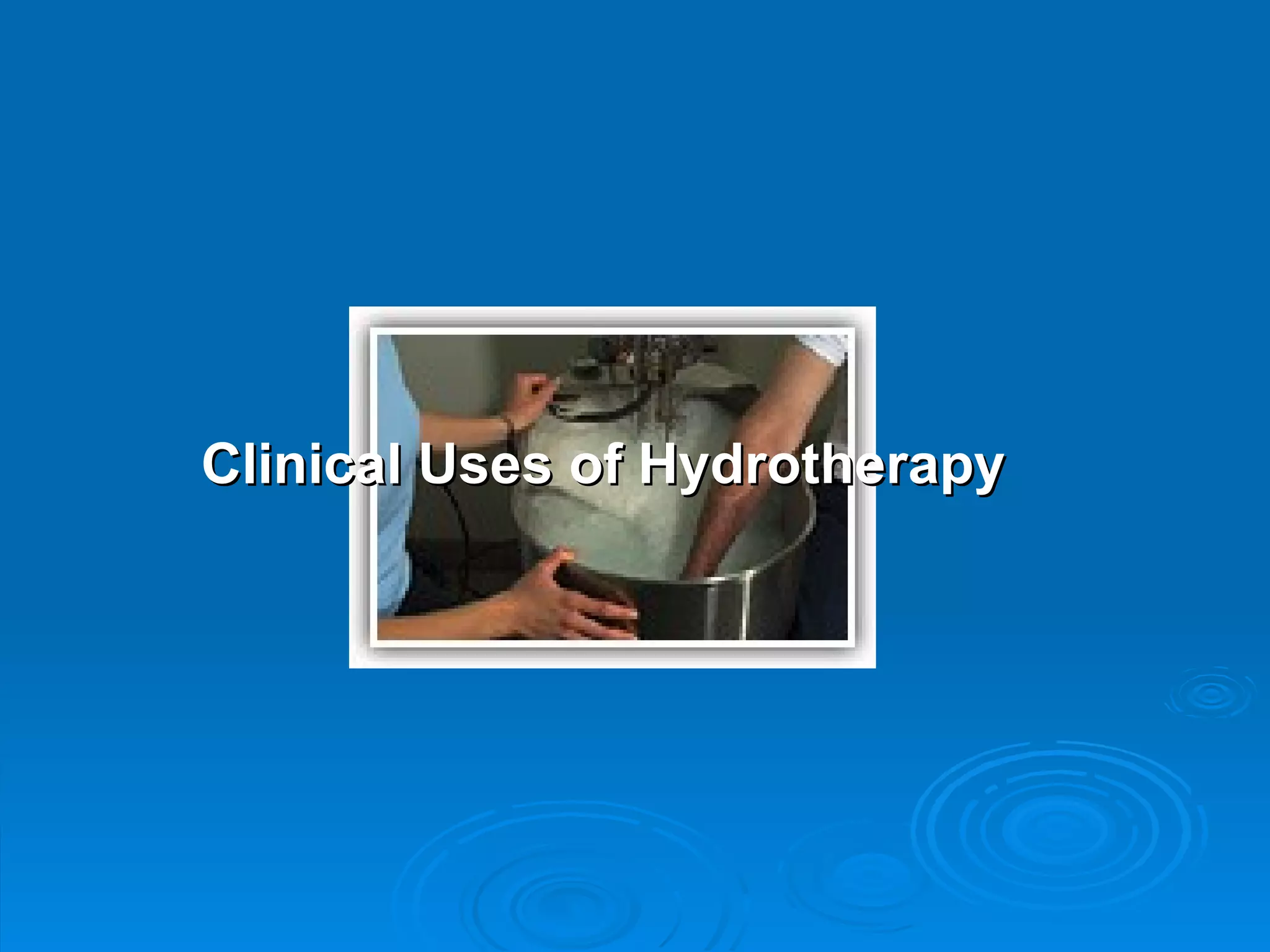 Hydrotherapy | PPT