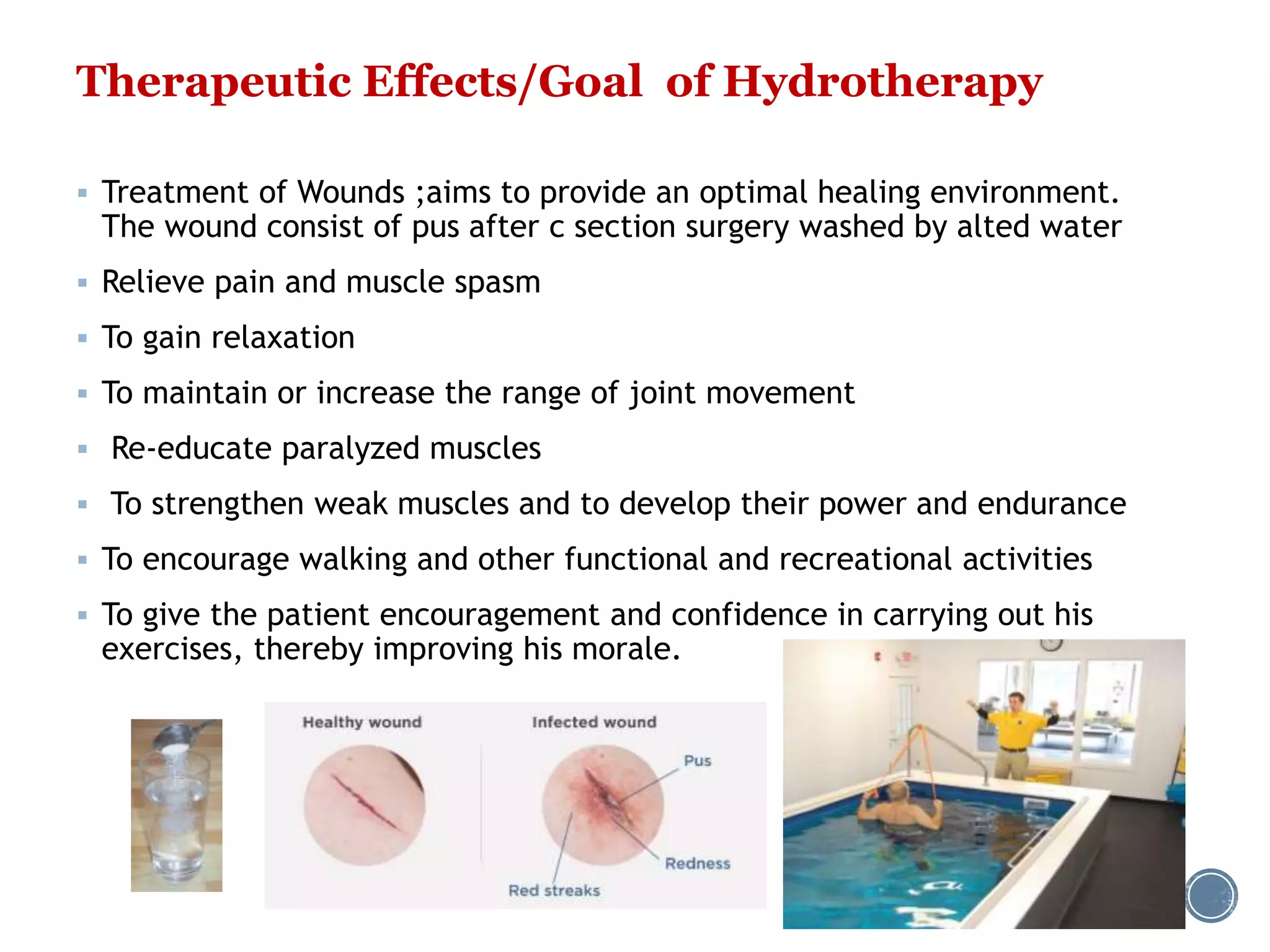Hydrotherapy | PPTX