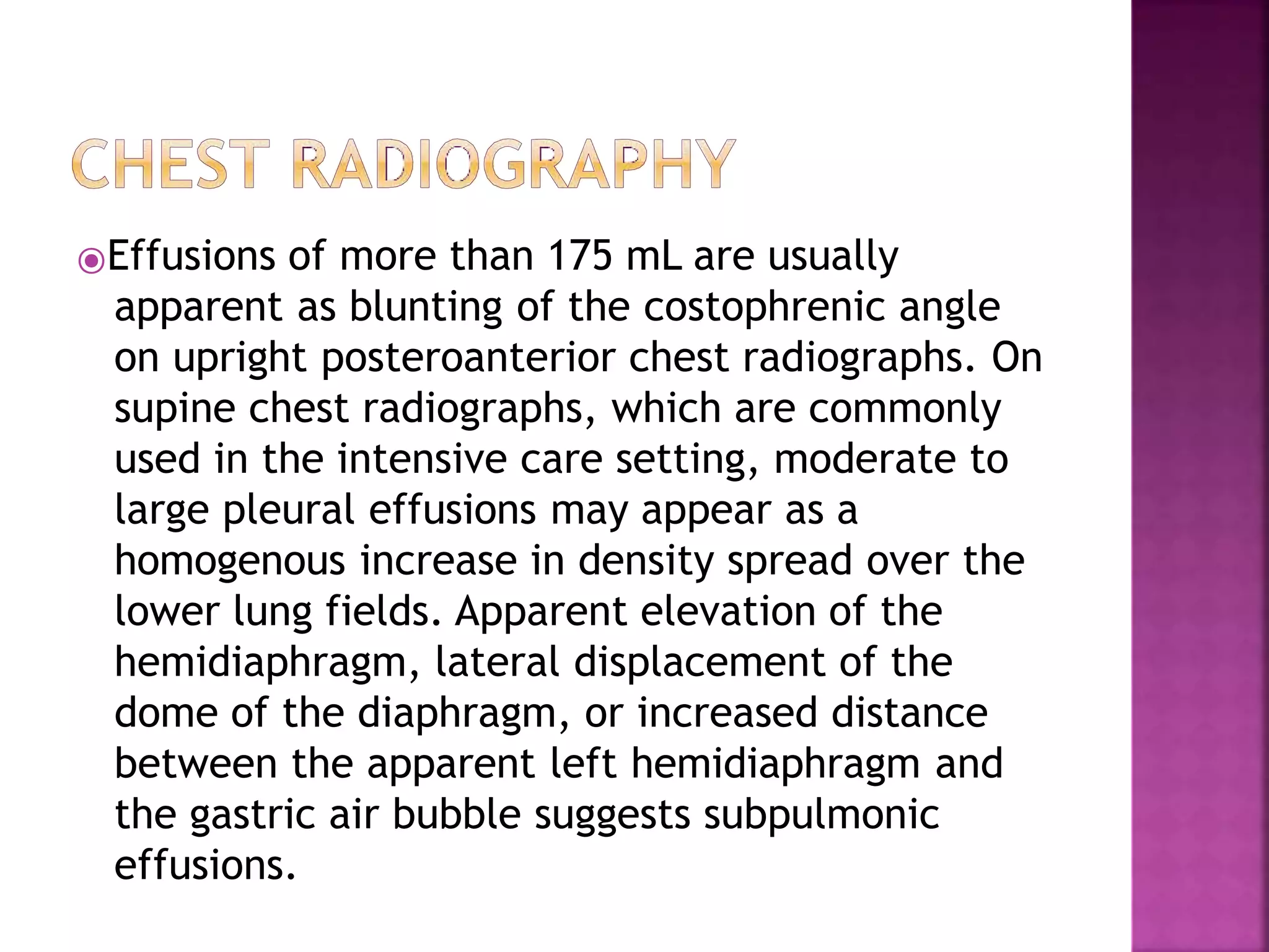 hydrothorax presentation.pptx