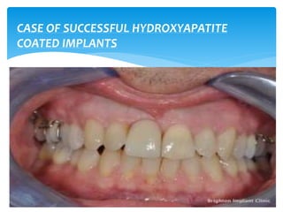 Hydroxyapatite and their use as coating material in dentistry | PPTX