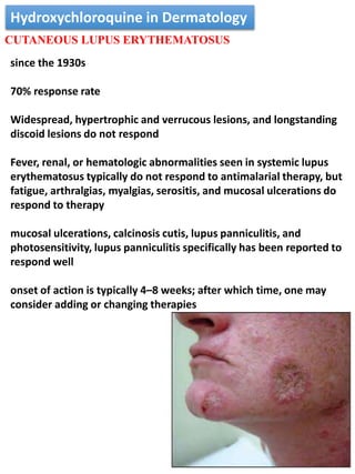 Hydroxychloroquine | PPTX