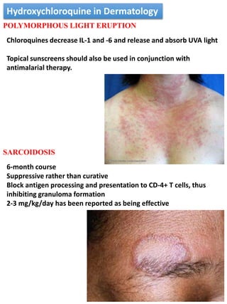 Hydroxychloroquine | PPTX
