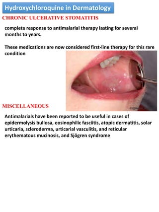 Hydroxychloroquine | PPTX
