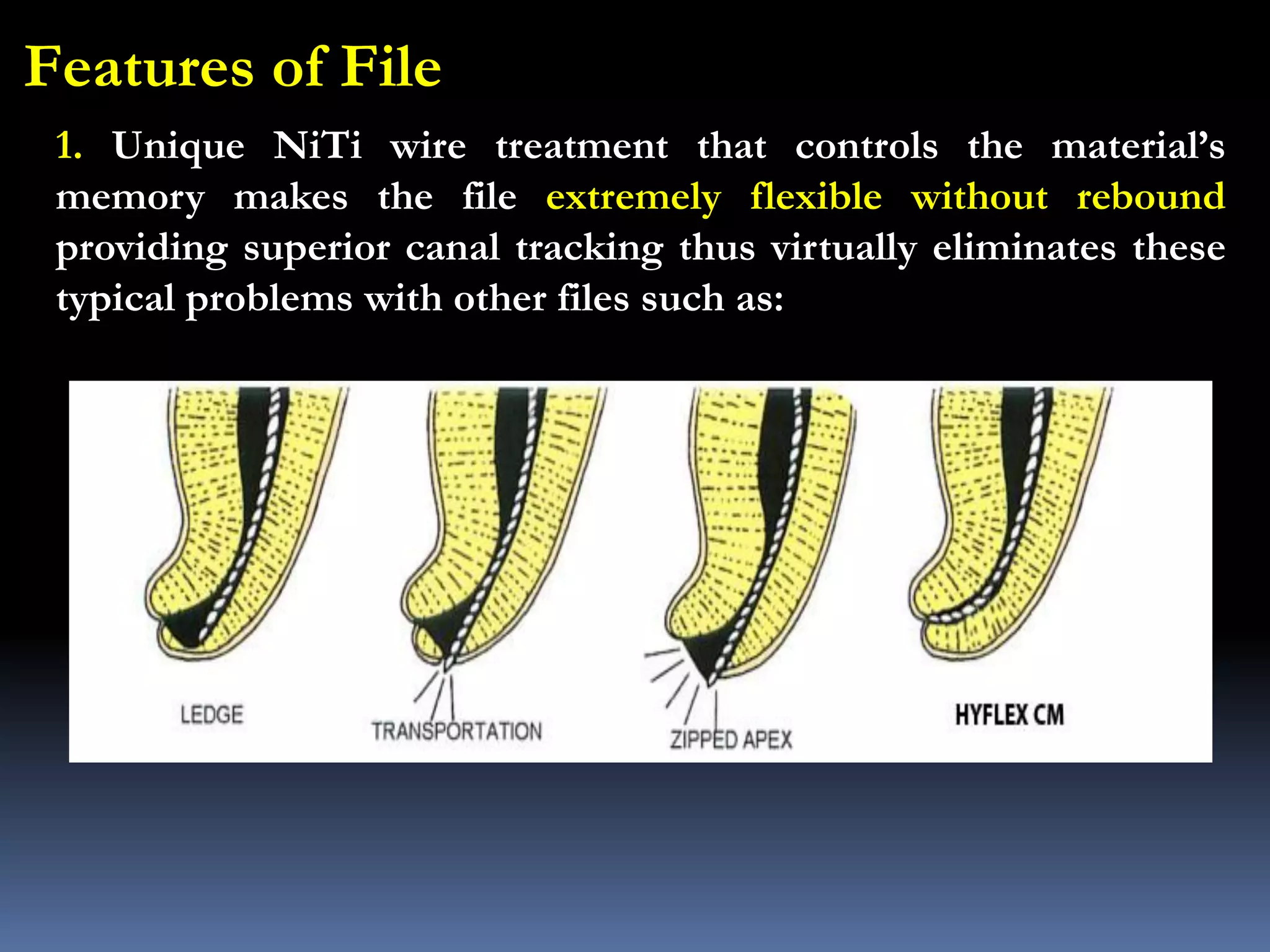 HyFlex CM File | PDF