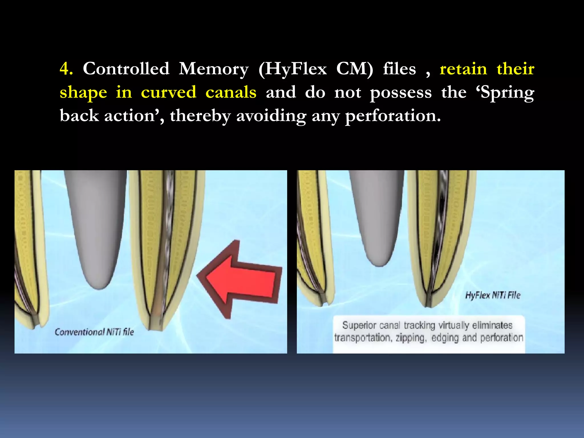 HyFlex CM File | PDF