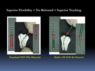 HyFlex CM File | PDF