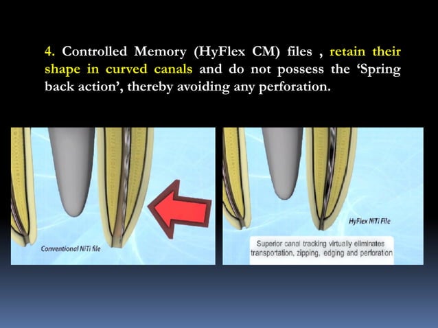 HyFlex CM File | PDF