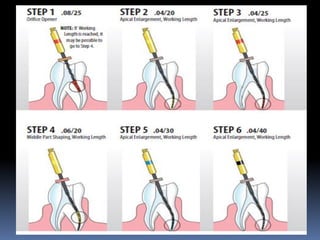 HyFlex CM File | PDF