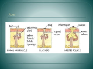 Hygiene | PPT