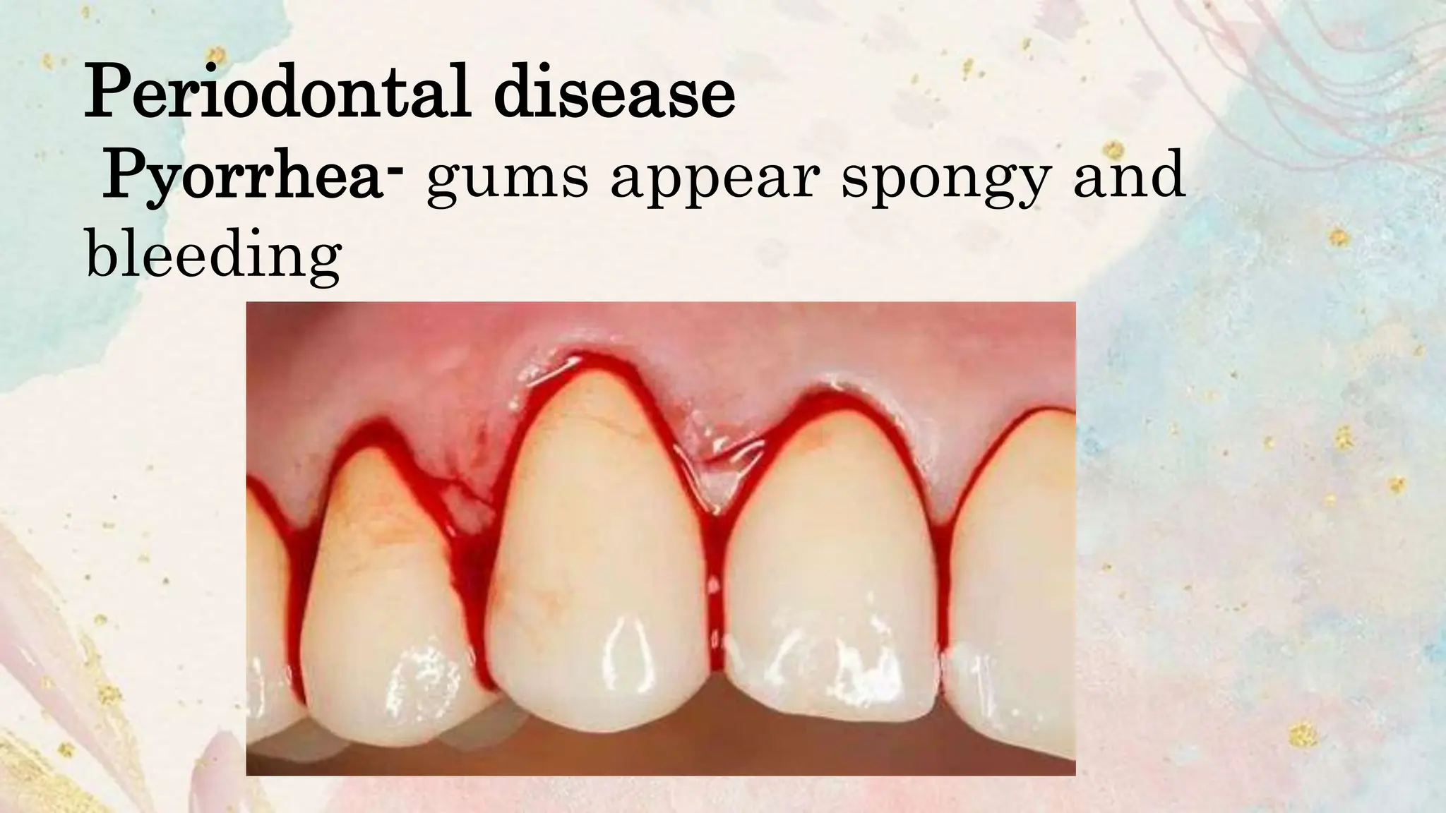 hygiene care used in the field of Caregiving | PPTX