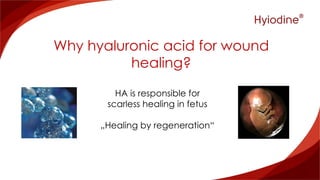 Hyiodine 2012 presentation for clinicians and nurses | PPT