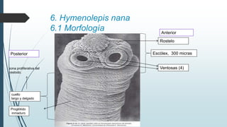 Hymenolepiasis.pptx