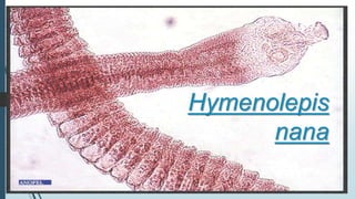 Hymenolepiasis.pptx