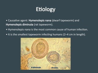 Hymenolepiasis Presentation full overview | PPTX