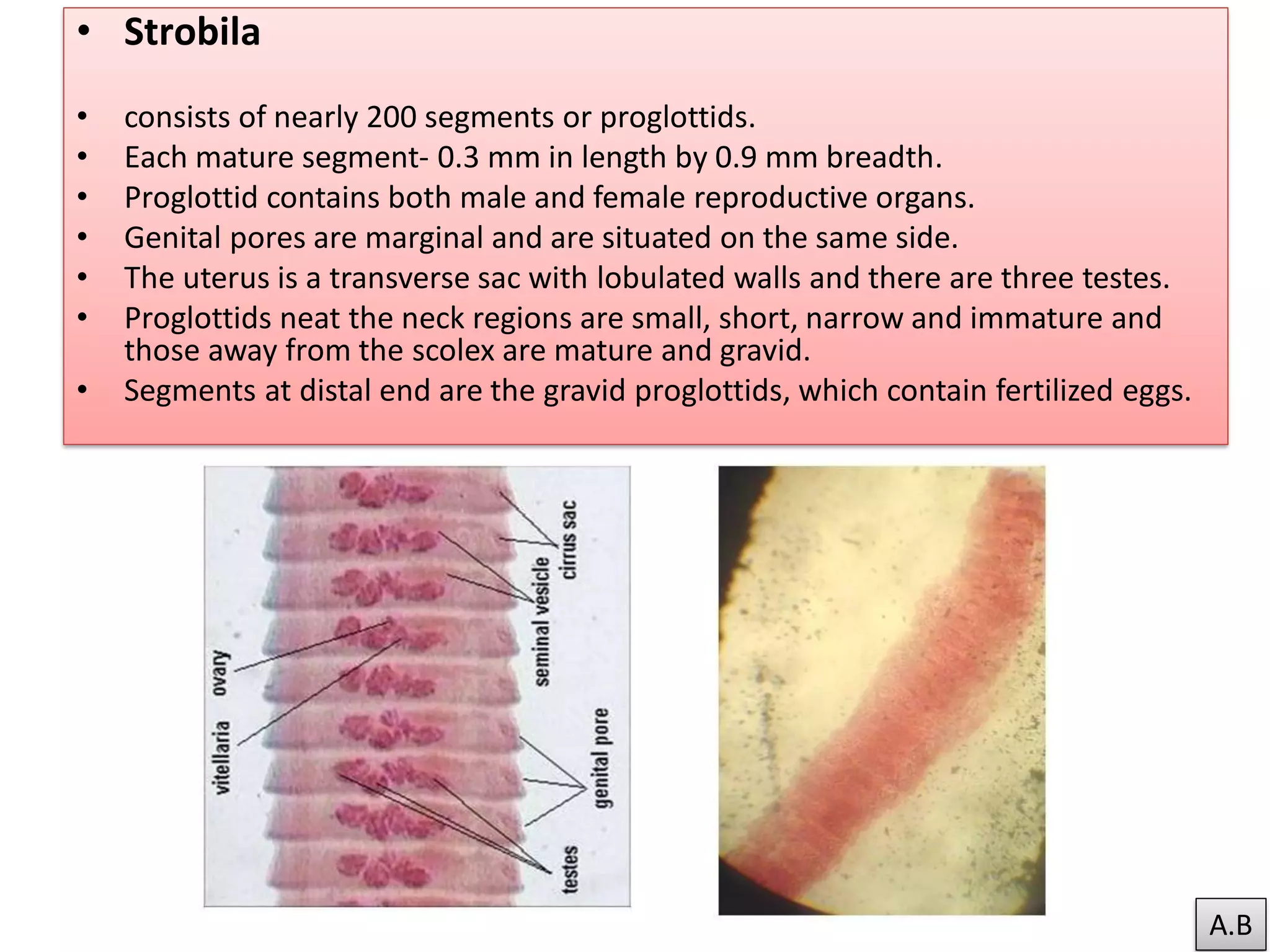 Hymenolepis nana- Dwarf Tapeworm | PDF