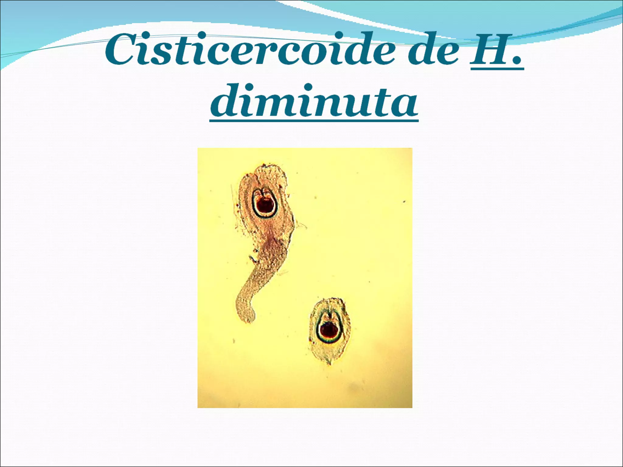 Hymenolepis nana y diminuta | PPS