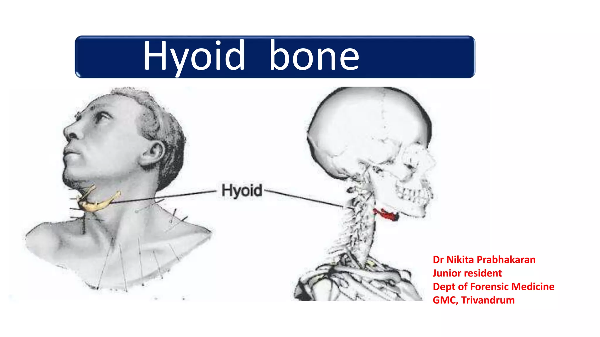 ANATOMY OF THE Hyoid bone | PDF