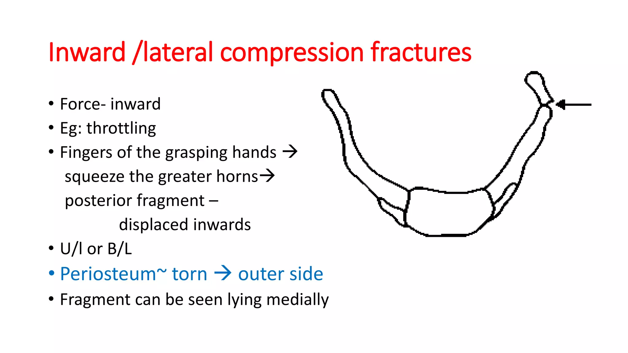 ANATOMY OF THE Hyoid bone | PDF