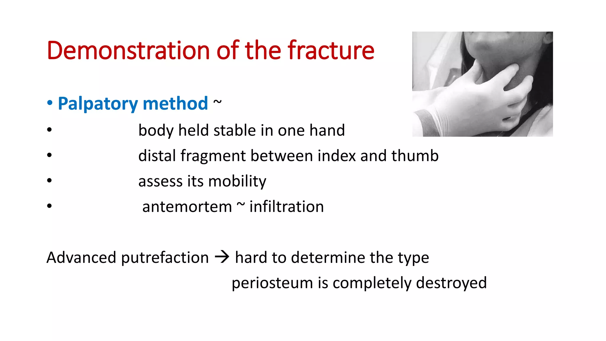 ANATOMY OF THE Hyoid bone | PDF