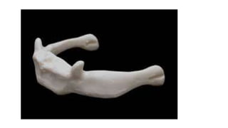 ANATOMY OF THE Hyoid bone | PDF