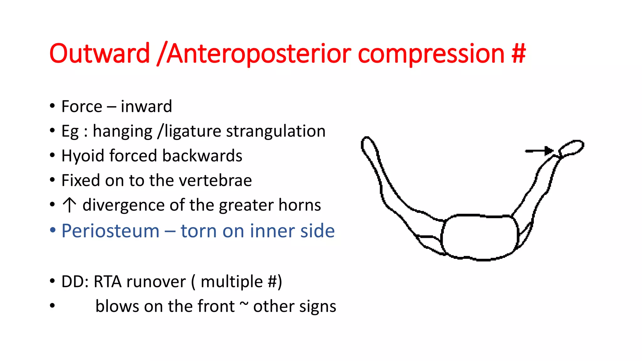 Hyoid bone | PPTX