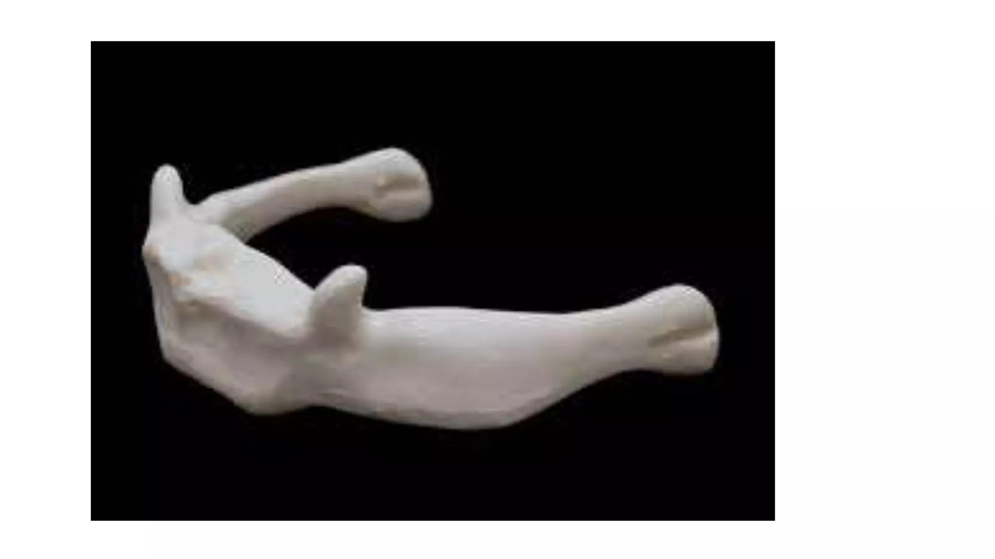 Hyoid bone | PPTX | Bone and Joint Conditions | Diseases and Conditions