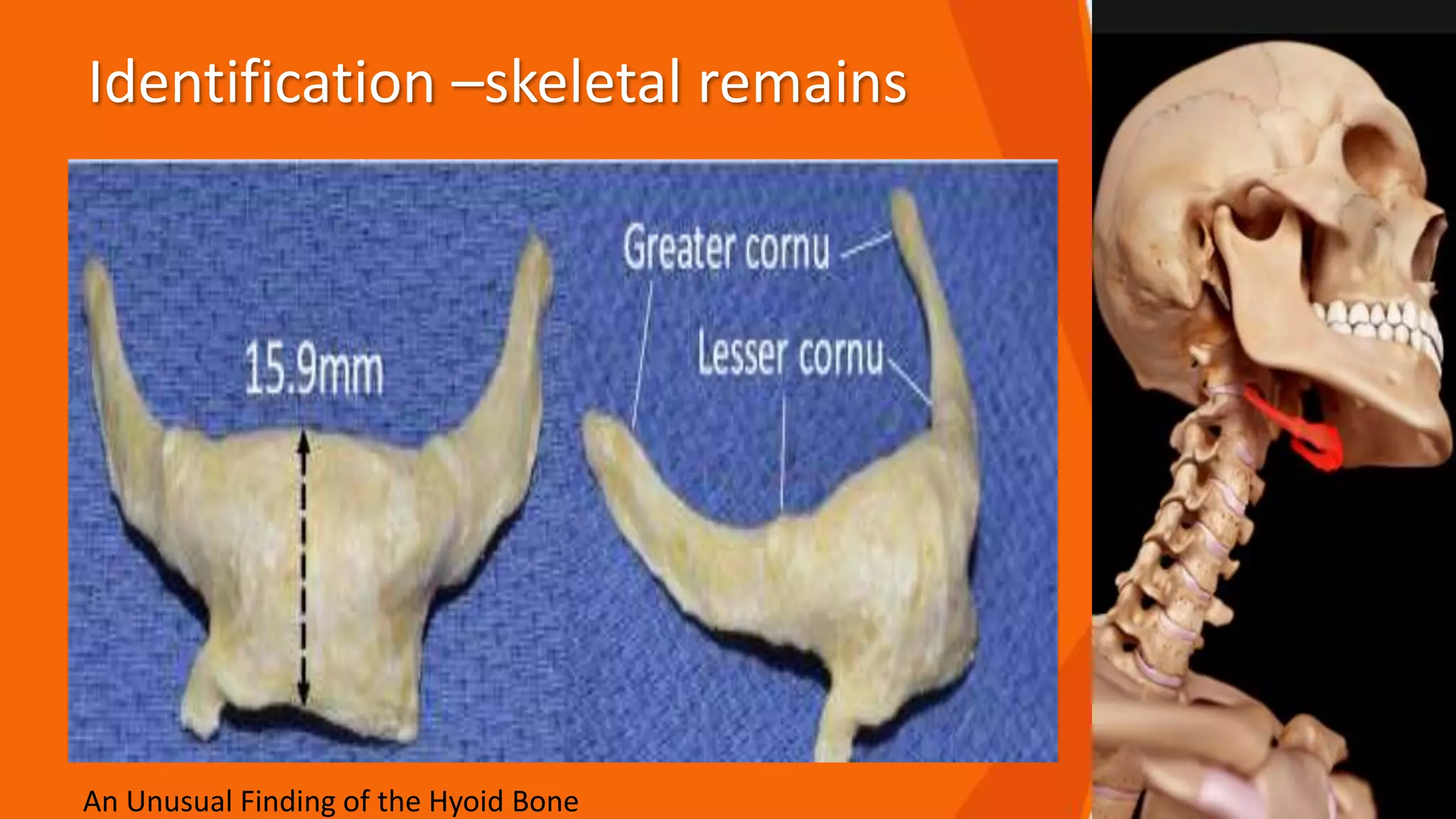 Hyoid bone journal | PPTX