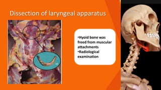 Hyoid bone journal | PPTX