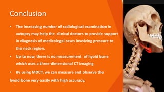 Hyoid bone journal | PPTX