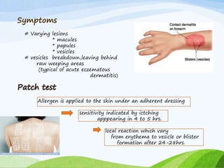 Hypersensitivity reaction iv | PPT