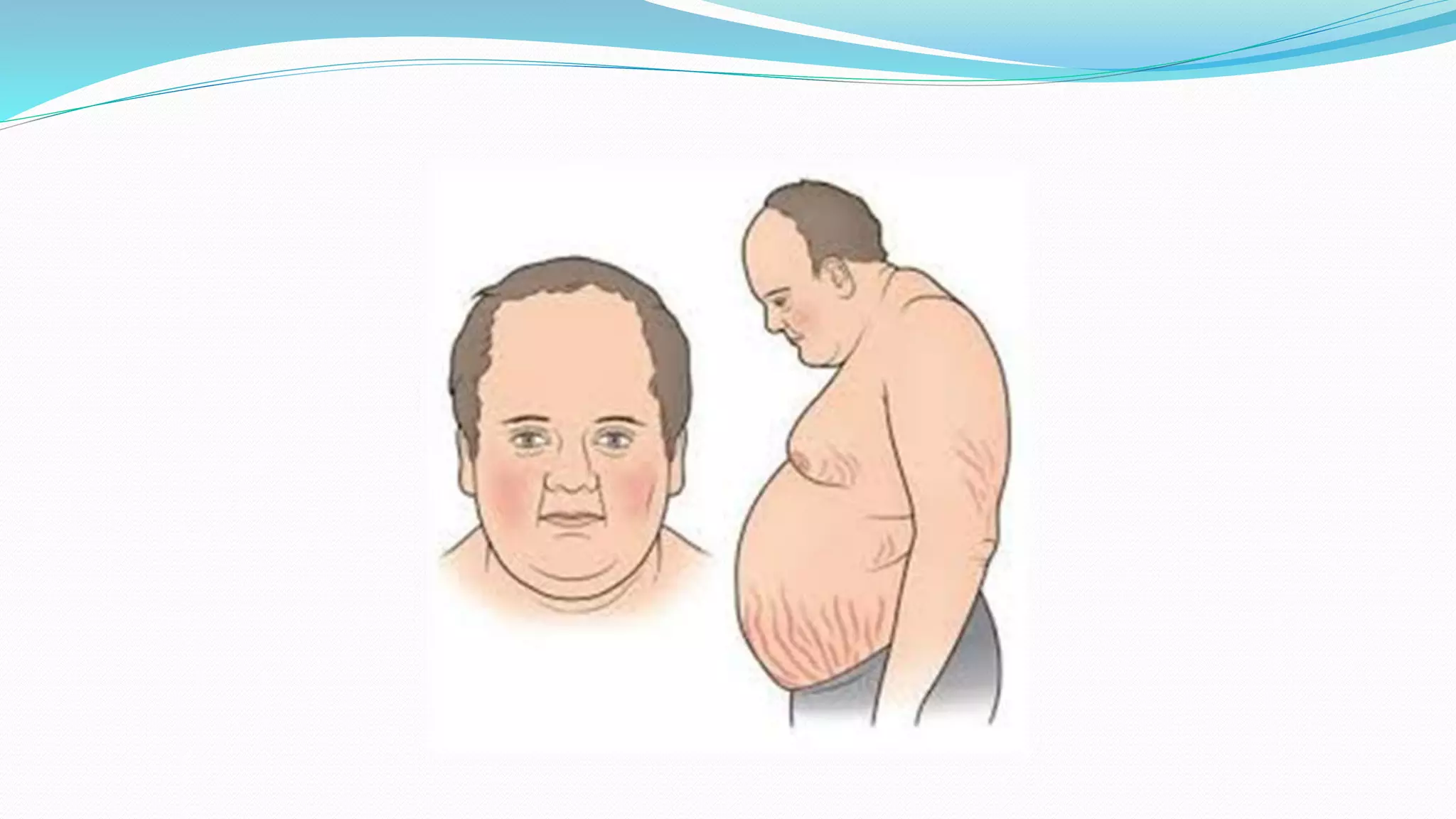 Hyperactivity of anterior pituitary gland | PPTX