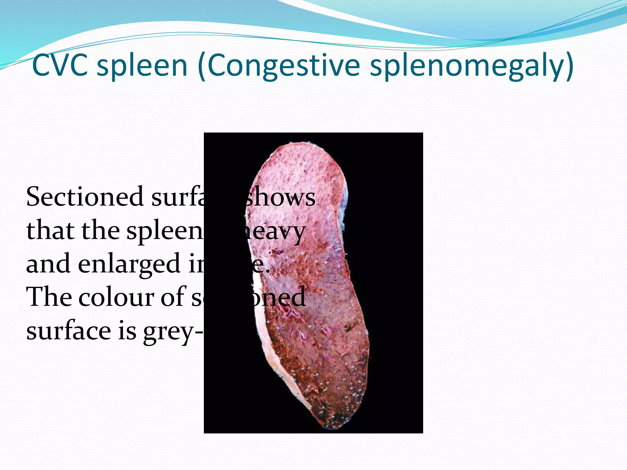 HYPERAEMIA & CONGESTION | PPTX