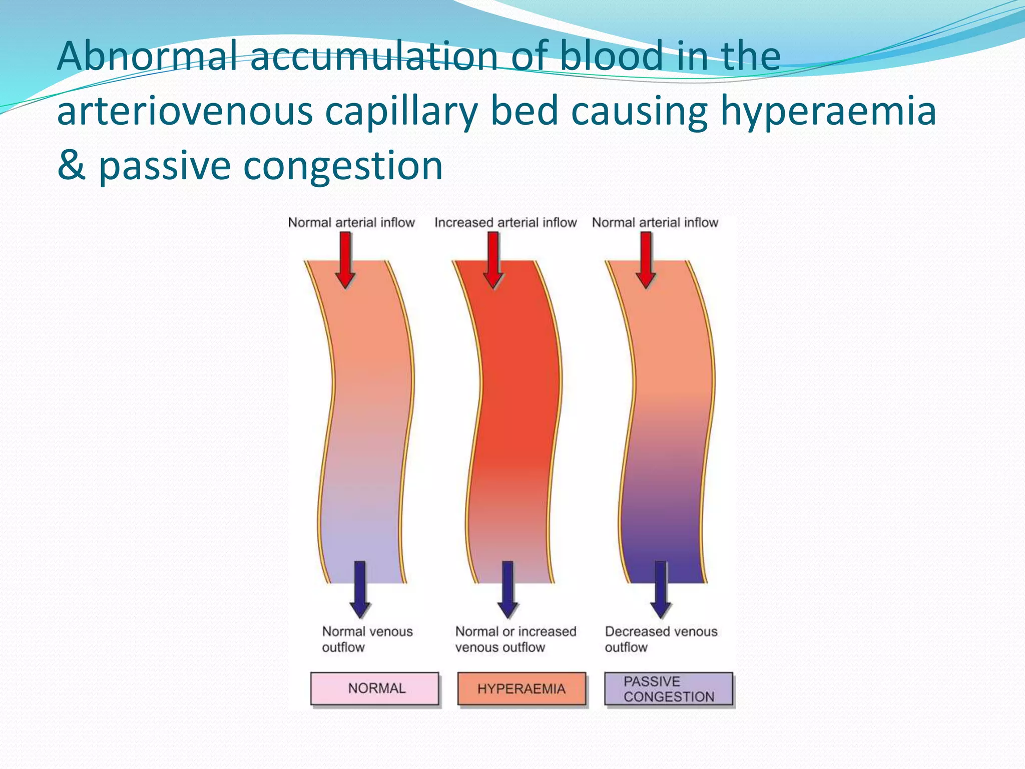 HYPERAEMIA & CONGESTION | PPTX