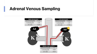 Hyperaldosteronism | PDF
