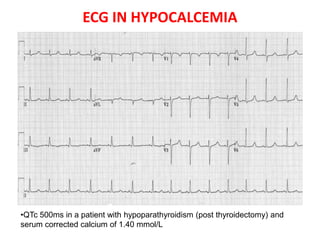 hyper and hypocalcemia.pptx