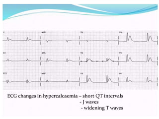 hyper and hypocalcemia.pptx