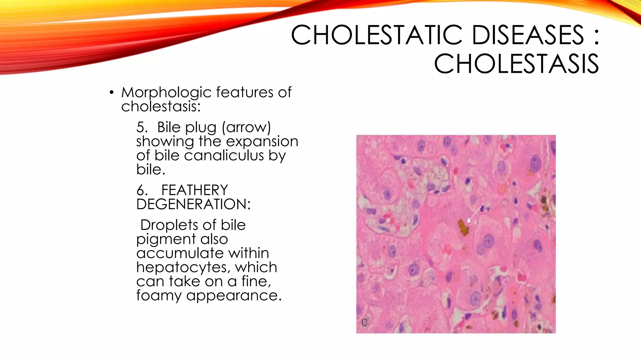 Hyperbilirubinemia | PPTX