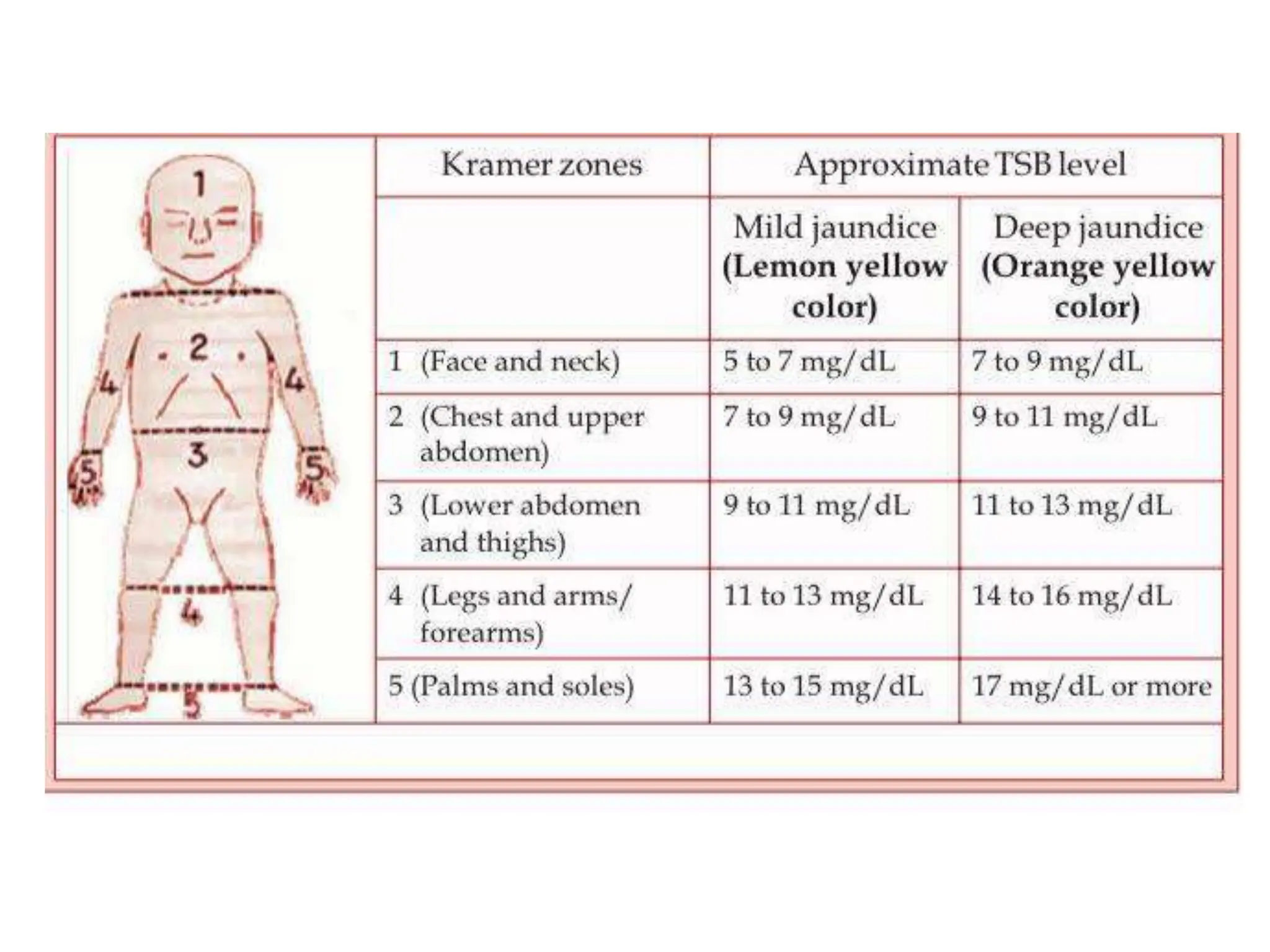 unit 3 nursing care of a neonate Hyperbilirubinemia neonate.ppt