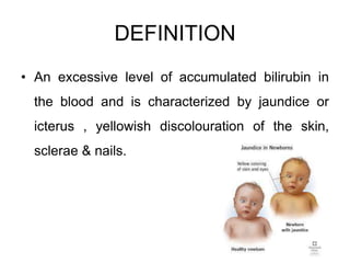 unit 3 nursing care of a neonate Hyperbilirubinemia neonate.ppt